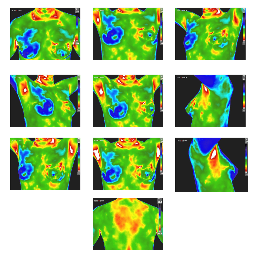 Thermography Pembroke Pines - Thermography Pembroke Pines